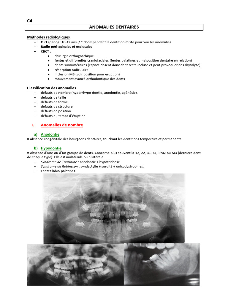 Anomalies dentaires : classification et radiologie | PDF | Dent humaine ...