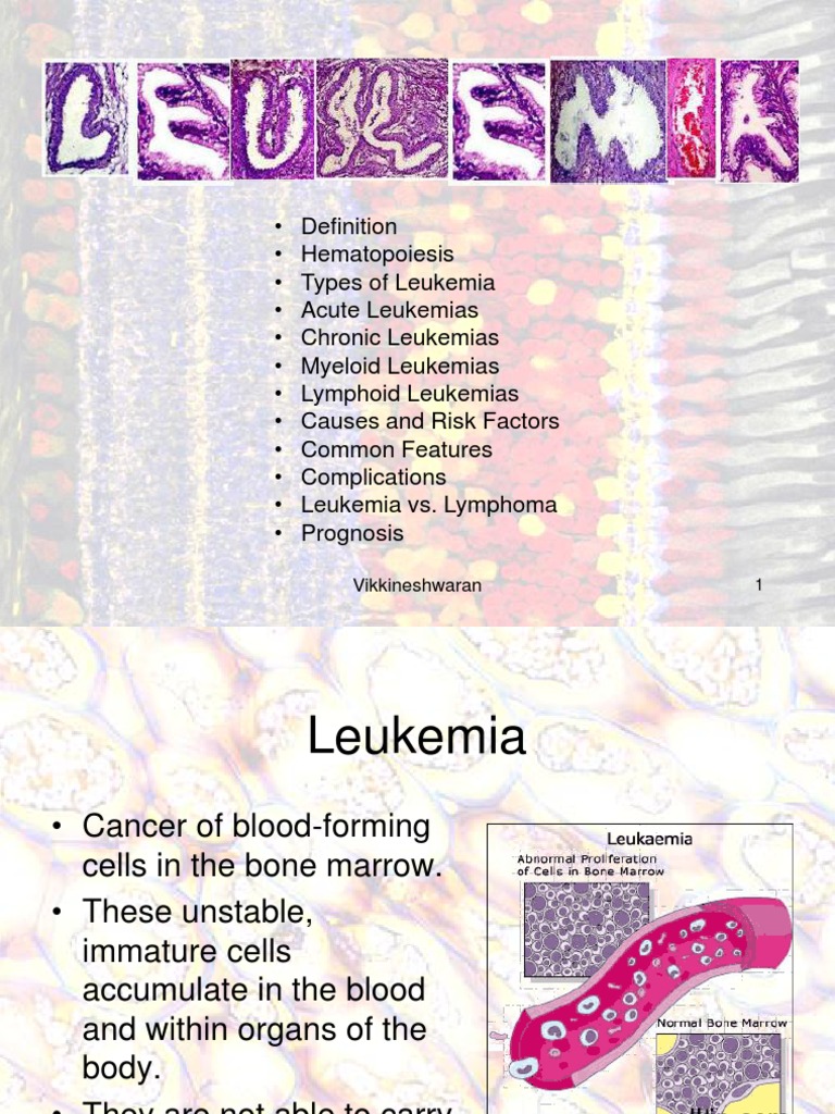 Leukemia | Leukemia | Haematopoiesis