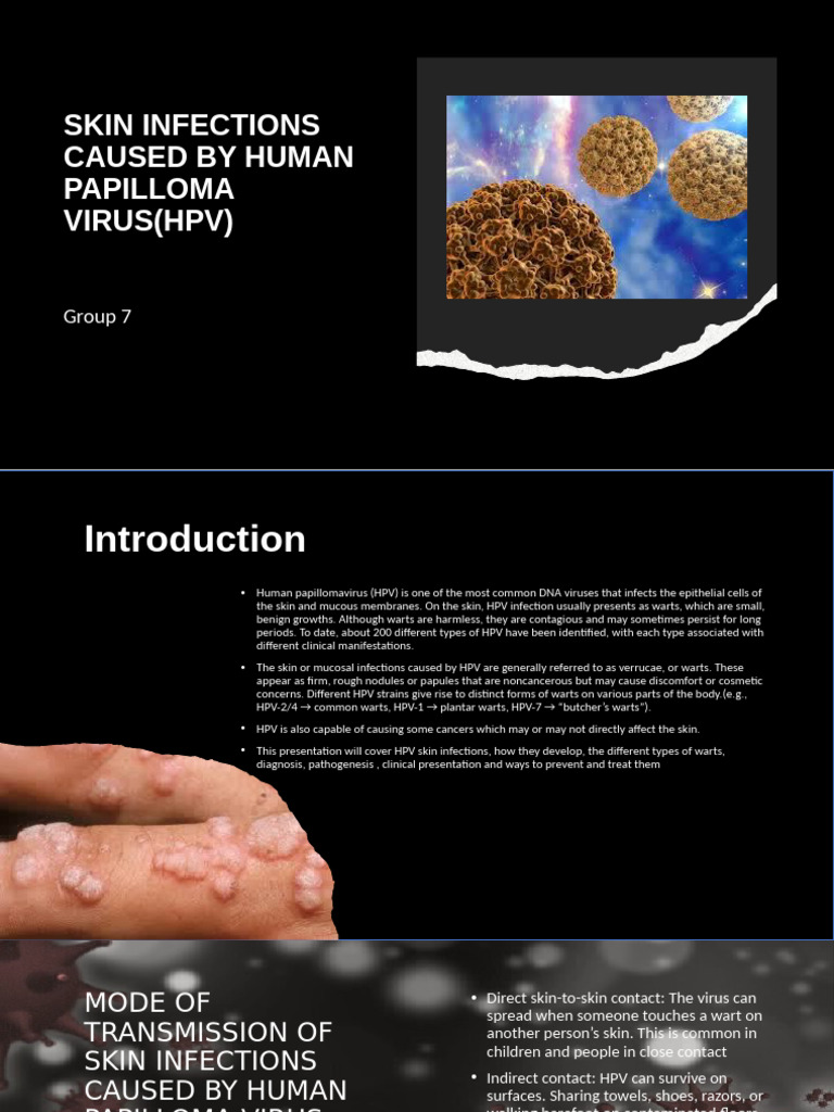 HPV Skin Infections: Types and Treatment | PDF | Virus | Medical ...