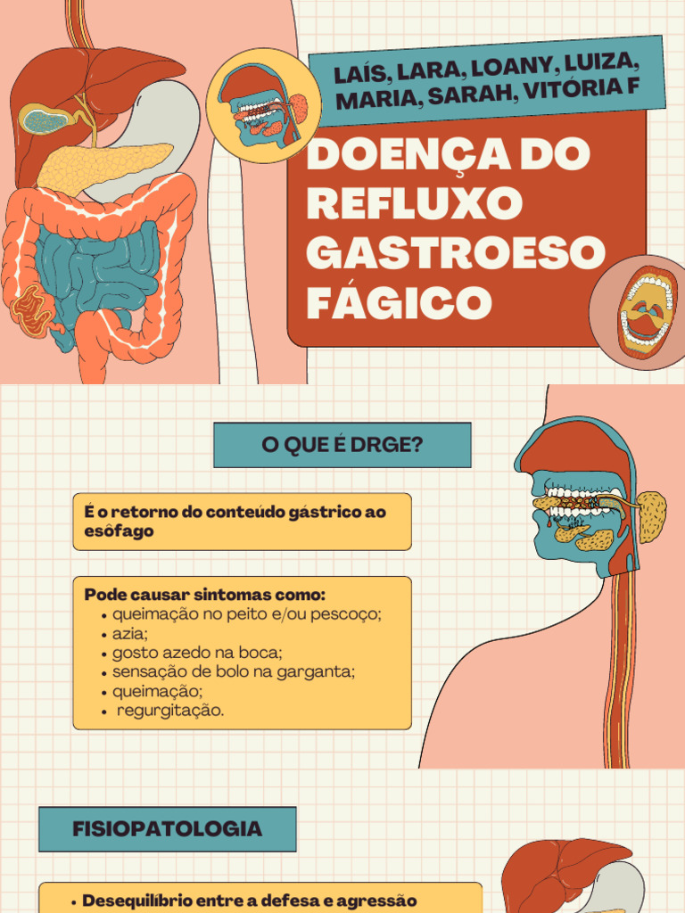 Guia Completo sobre Doença do Refluxo | PDF | Doença do refluxo ...