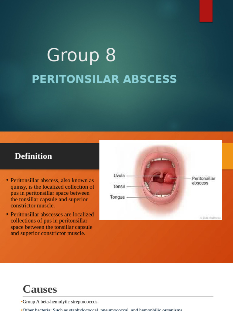 Peritonsilar Abscess | PDF | Diseases And Disorders | Medicine