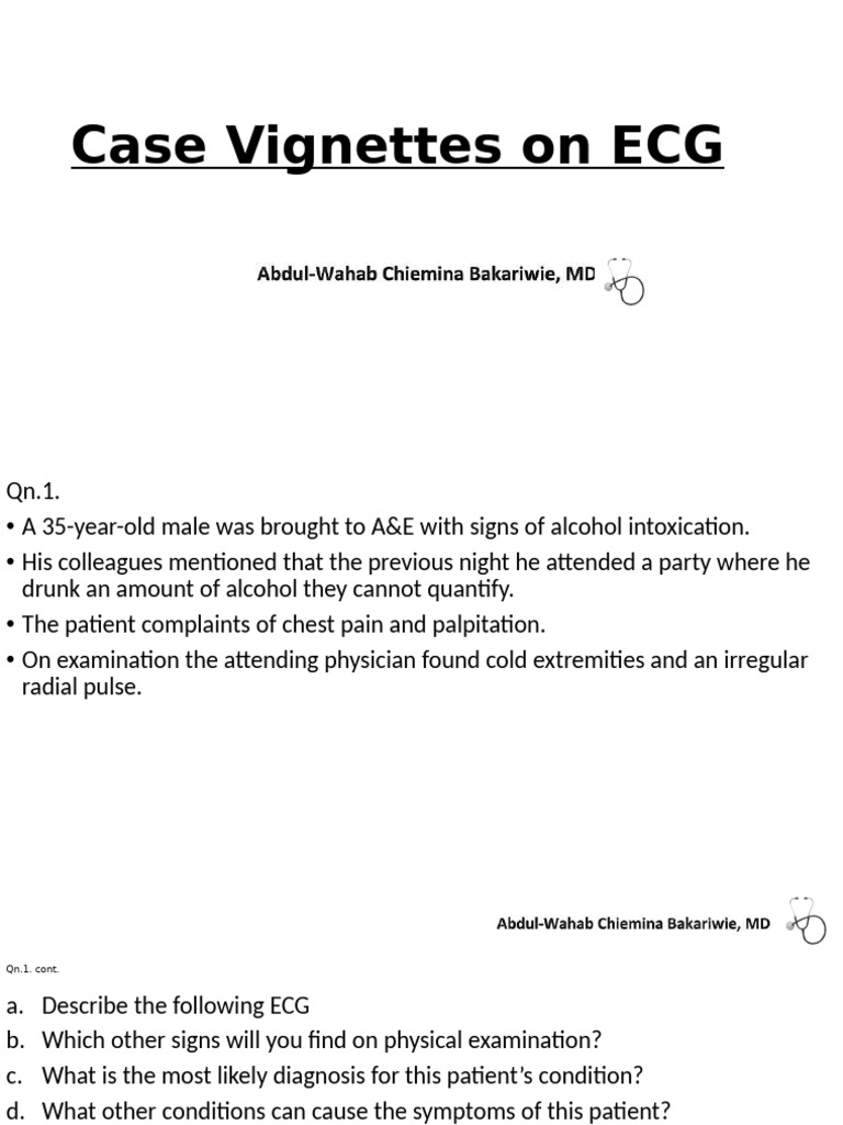 ECG Case Study: Alcohol-Induced Atrial Fibrillation | PDF ...