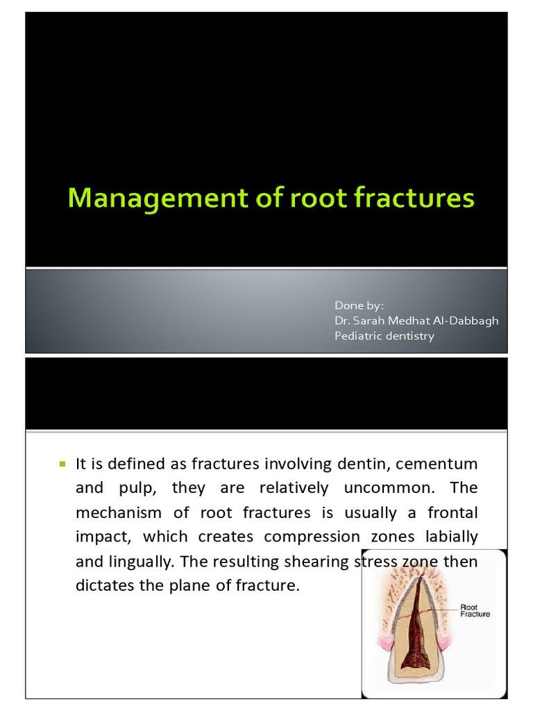 Understanding Root Fractures in Teeth | PDF | Human Tooth | Mouth