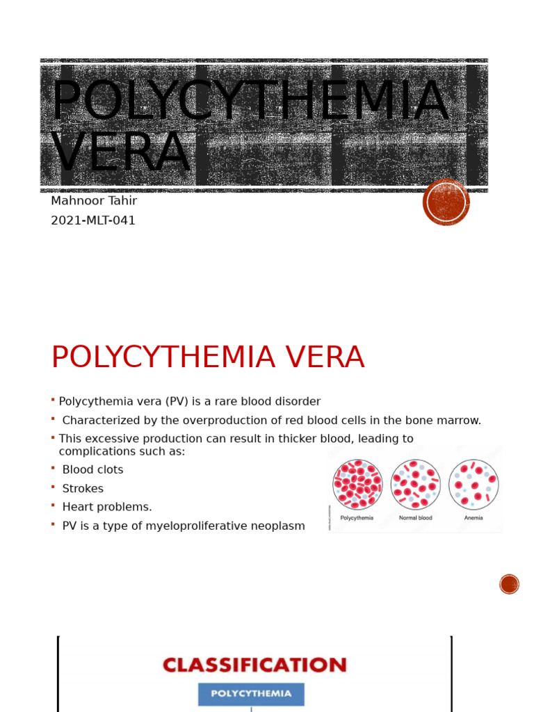 Polycythemia Vera Blood Disorder | PDF