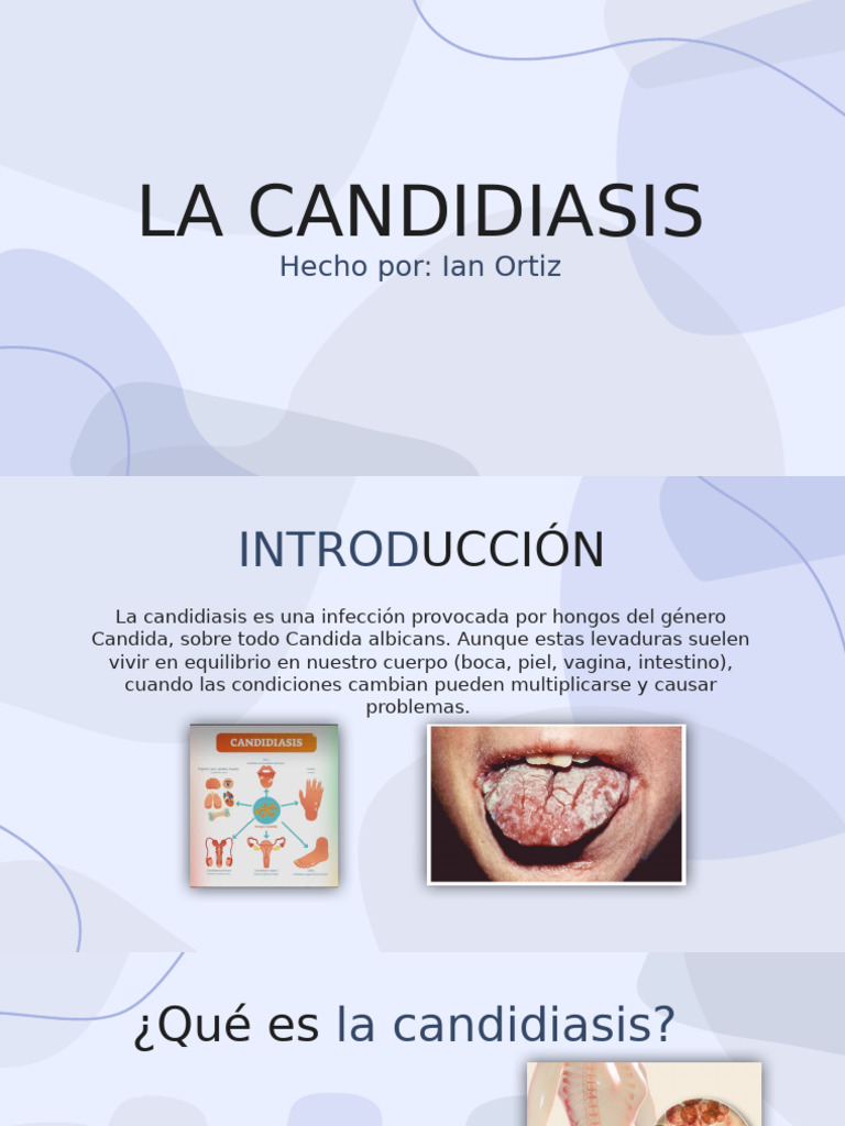 Candidiasis: Síntomas, Tratamiento y Prevención | PDF | Candidiasis ...