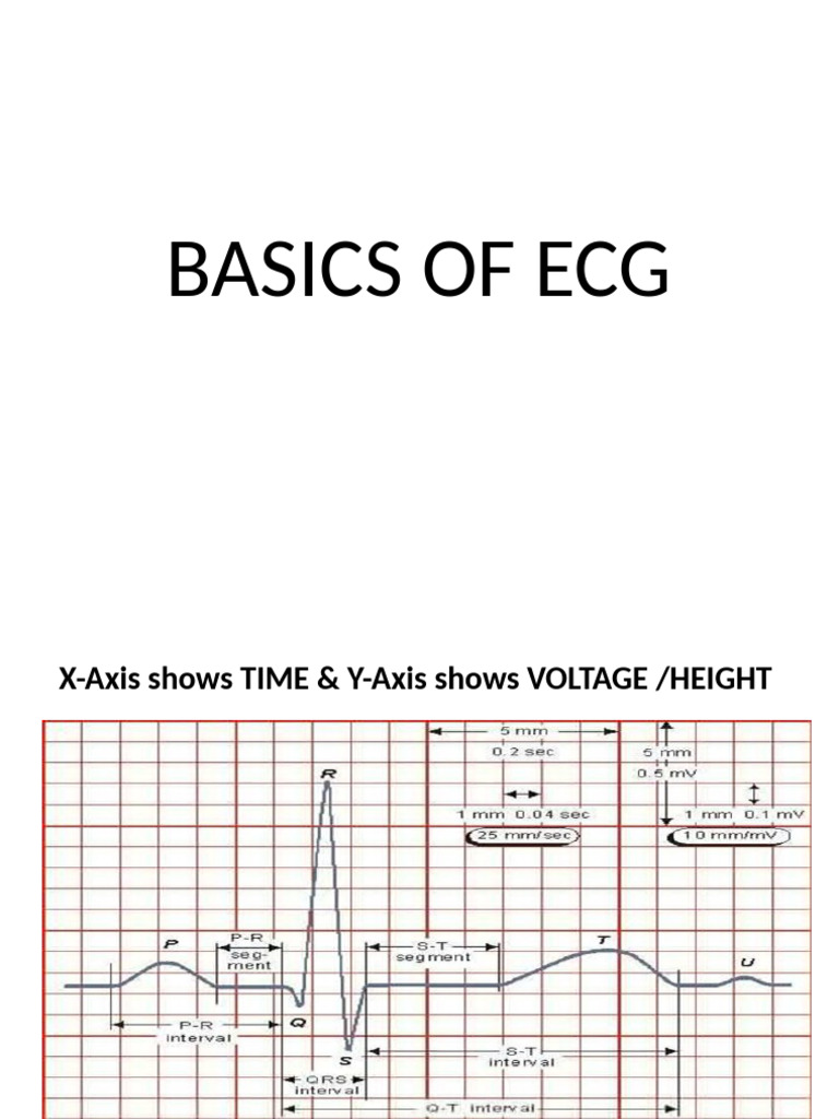 Ecg Presentation - Liaqat Ali | PDF | Electrocardiography | Circulatory System