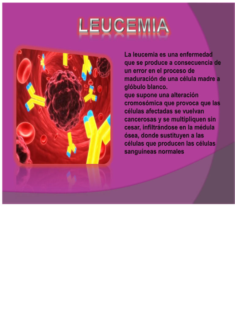 Faktor Risiko dan Prognosis Leukemia | PDF