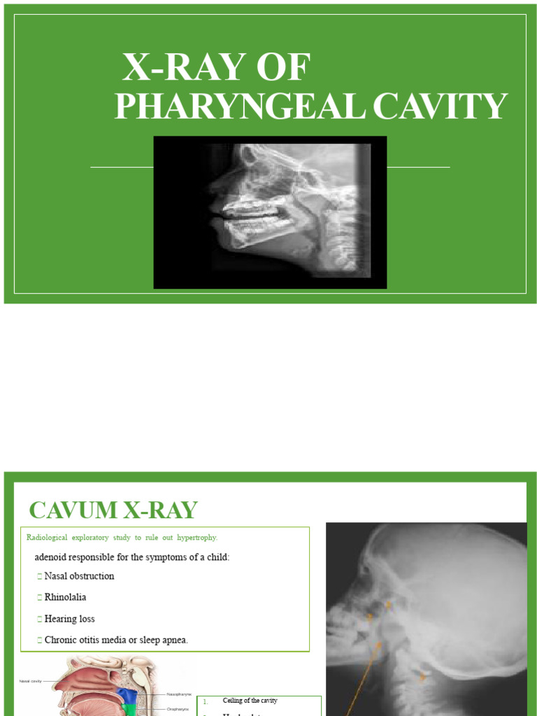 X-Ray of The Cavum and ATM | PDF | Musculoskeletal System | Human Head ...