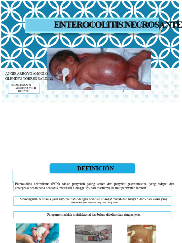 Enterokolitis Nekrotikans pada Neonatus | PDF