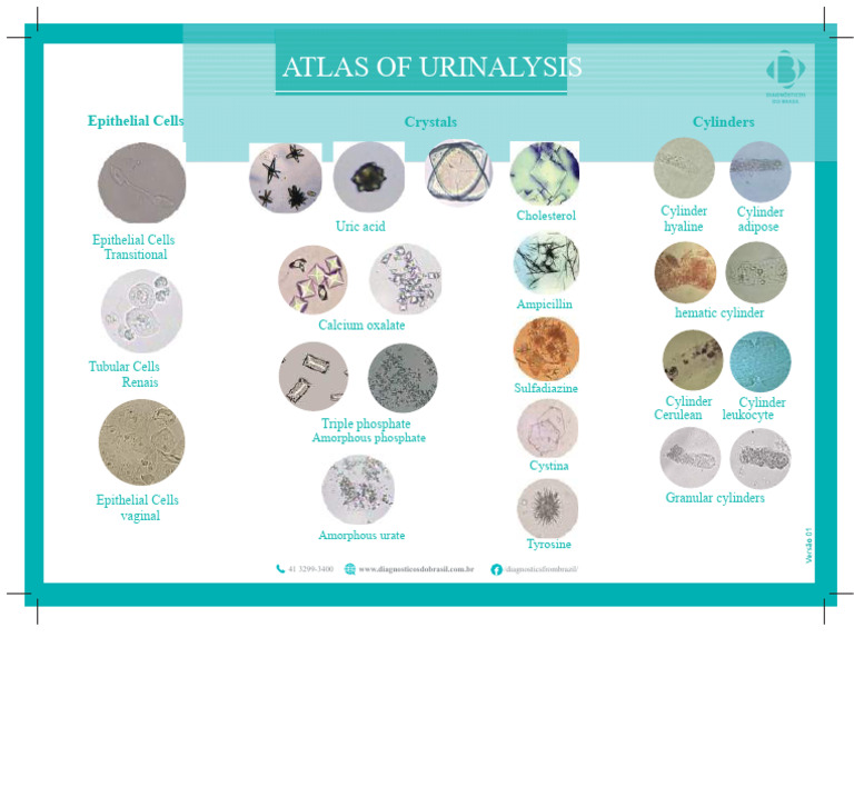 Atlas of Urinalysis: Cell Types & Crystals | PDF