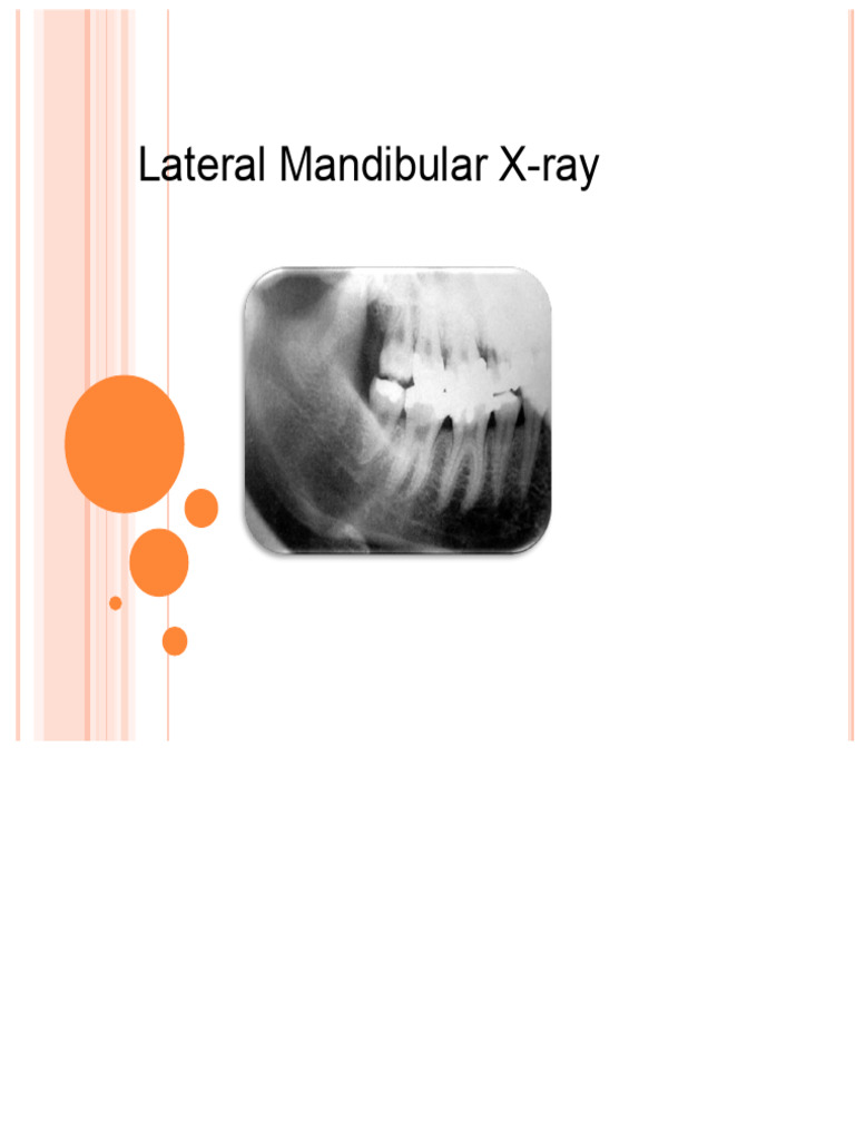 Lateral Mandibular X-ray Technique Guide | PDF | Dentistry Branches ...
