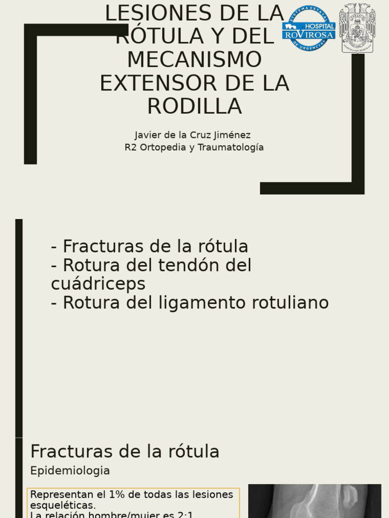 Lesiones de La Rótula y Del Mecanismo Extensor | PDF | Rodilla ...