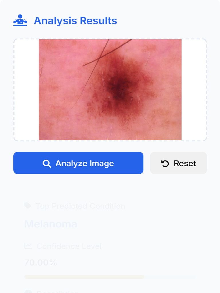 DermAI Analysis Report | PDF