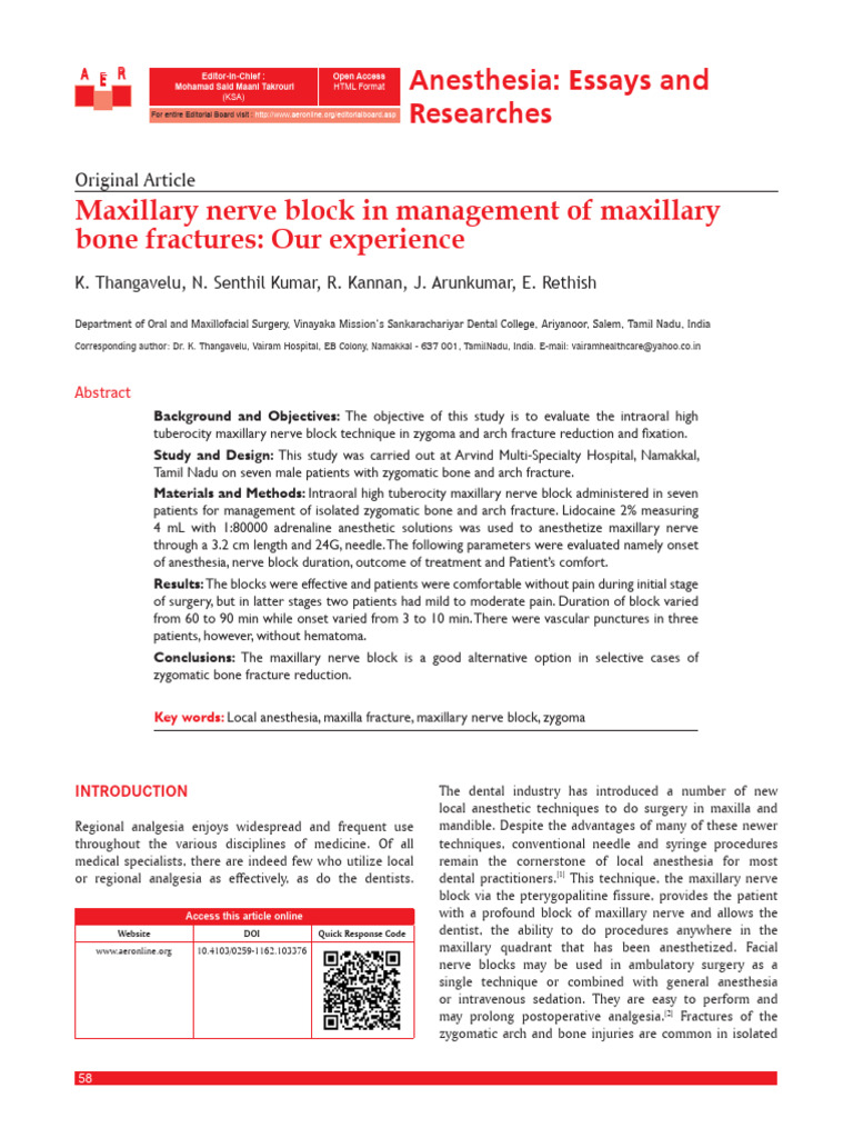 Maxillary Nerve Block for Zygomatic Fractures | PDF | Anesthesia | Surgery