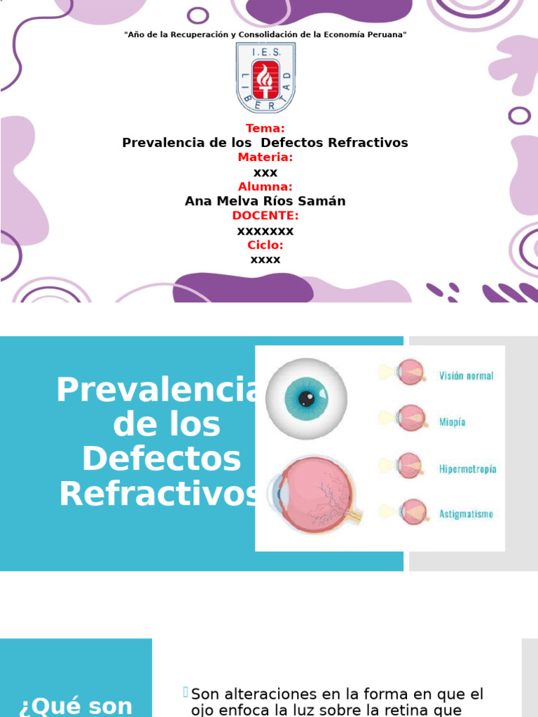 Prevalencia de Defectos Refractivos ANA MELVA | PDF | Miopía | Lentes