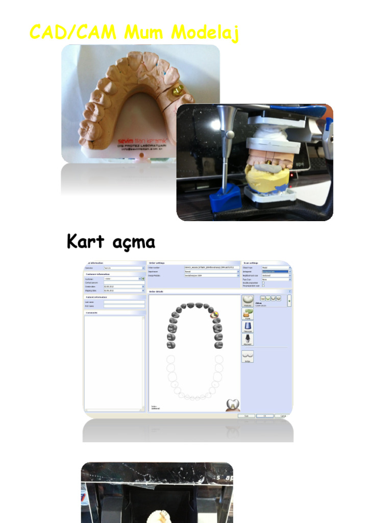 Implant Üstü Lab 2 | PDF