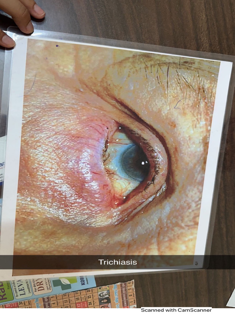 OPTHA Spotters CHART | PDF