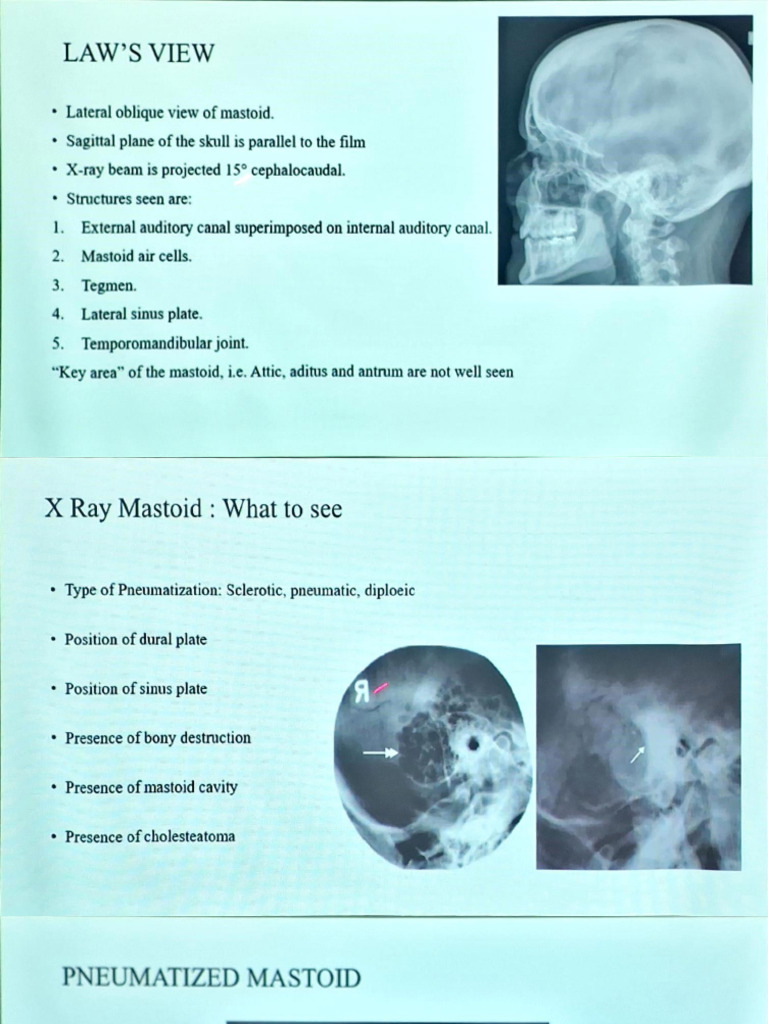 Otorhinolaryngology Xray | PDF | Larynx | Human Head And Neck