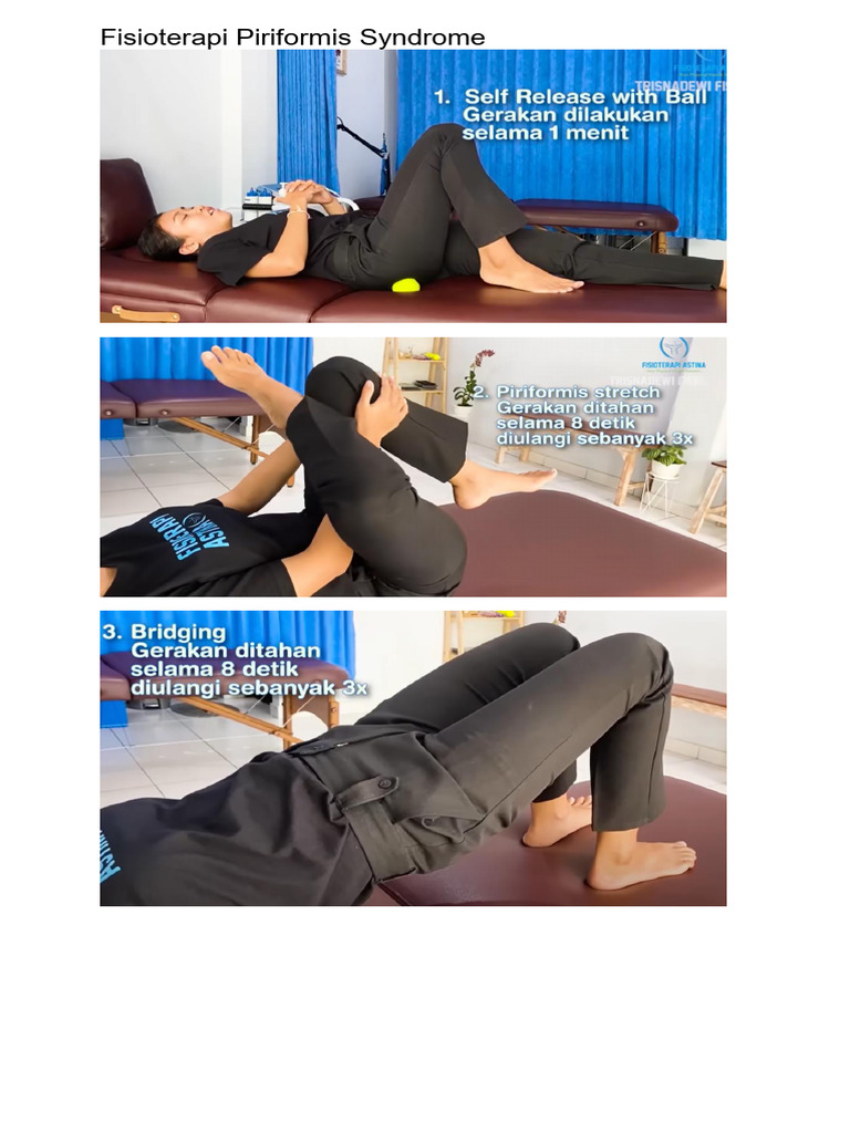 Fisioterapi Piriformis Syndrome | PDF
