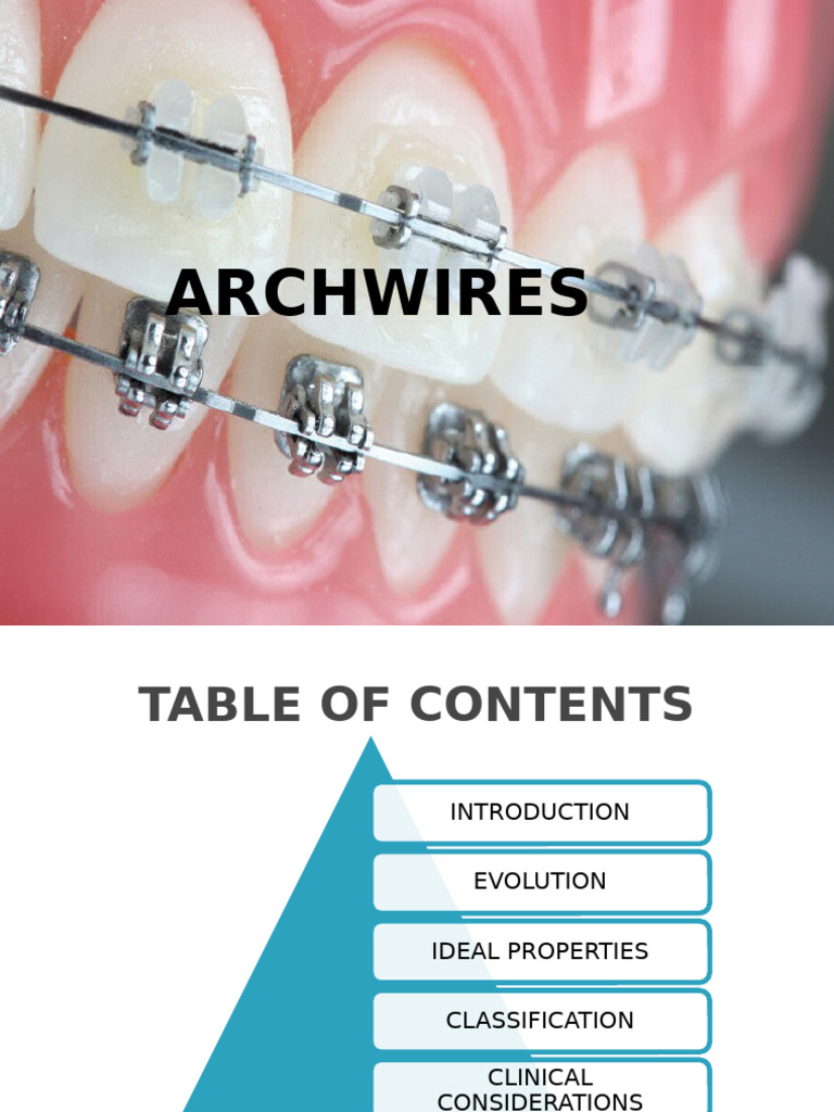 Arch Wires | PDF | Shape Memory Alloy | Deformation (Engineering)
