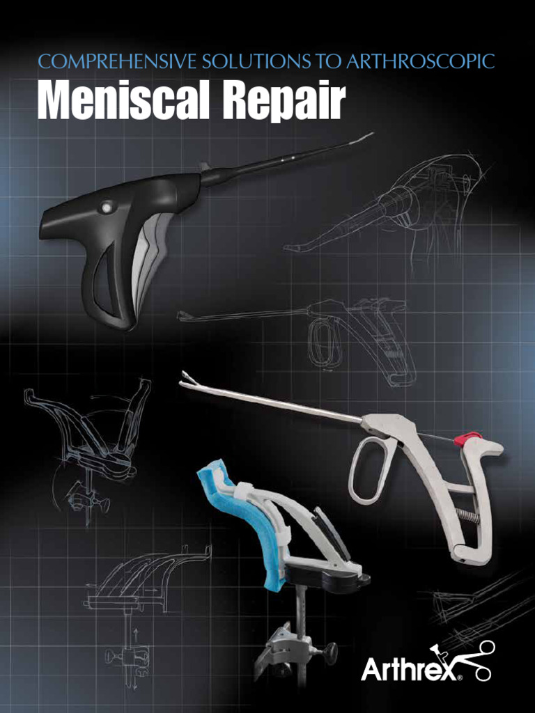 Comprehensive Solutions To Arthroscopic Meniscal Repair | PDF ...