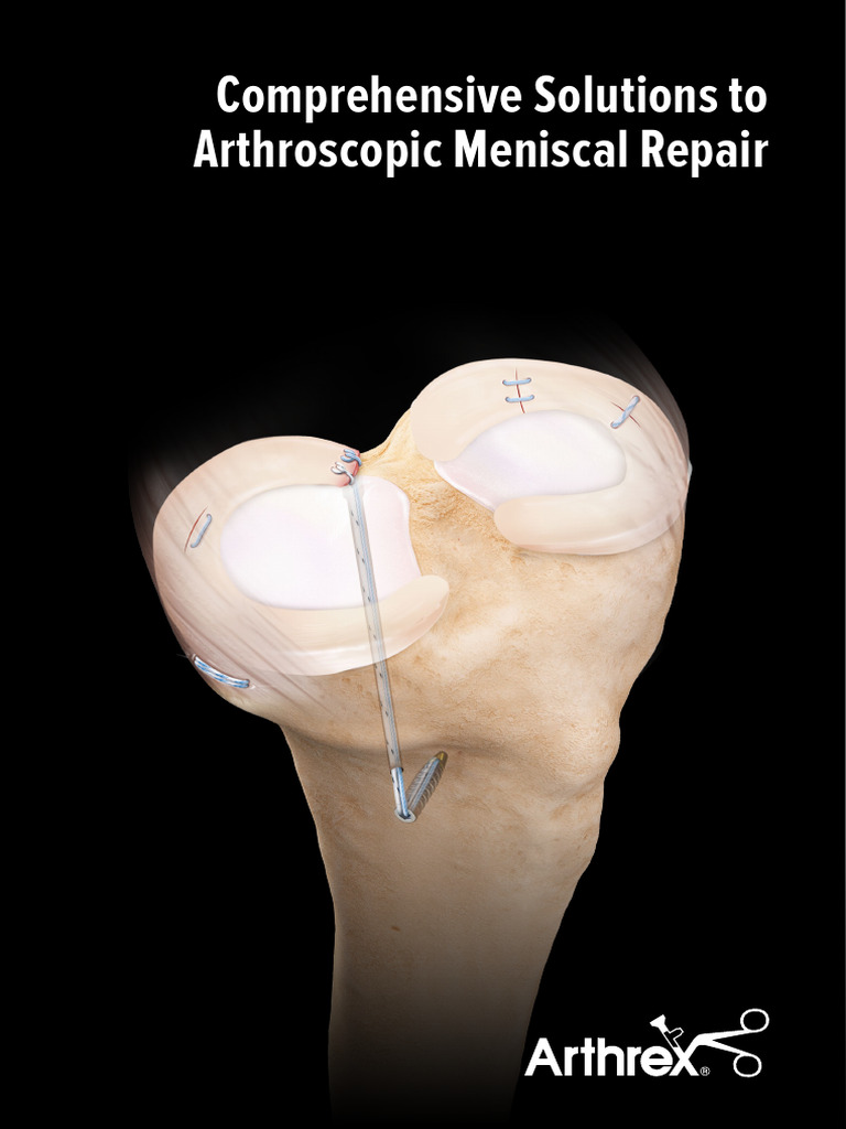 Meniscal Repair Solutions Overview | PDF | Knee | Surgical Suture