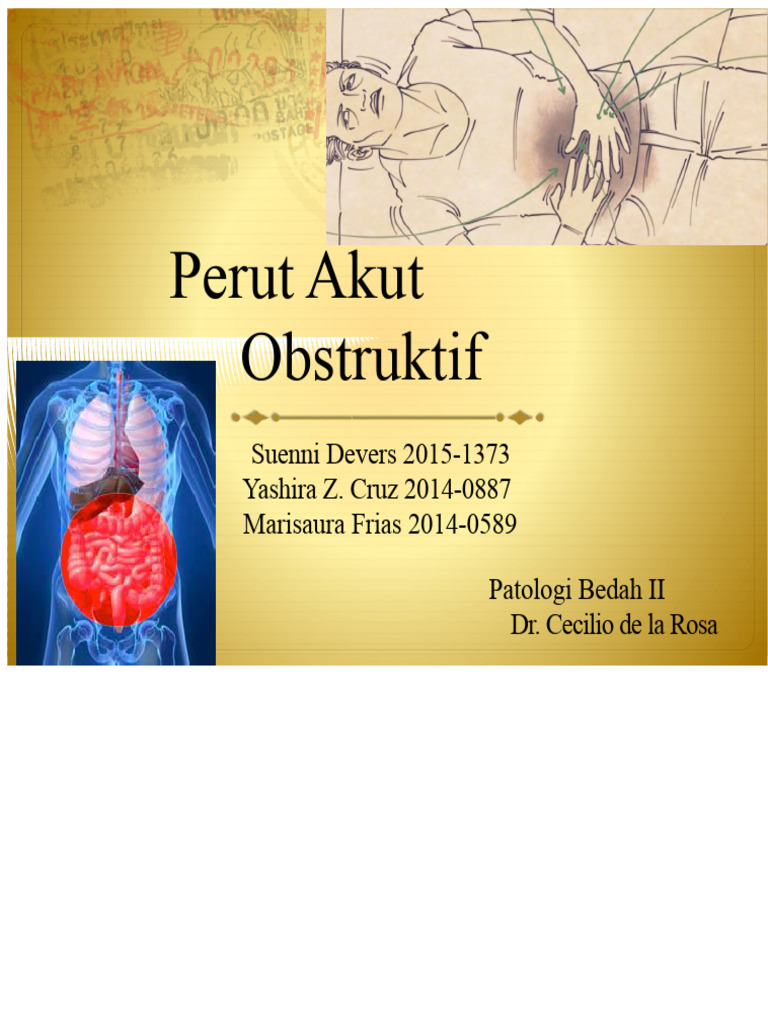 Perut Akut Obstruktif | PDF