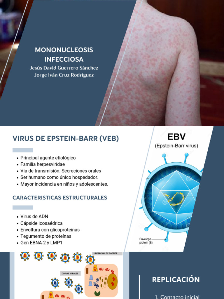 Mononucleosis Infecciosa: Causas y Tratamiento | PDF | Virología | Medicina