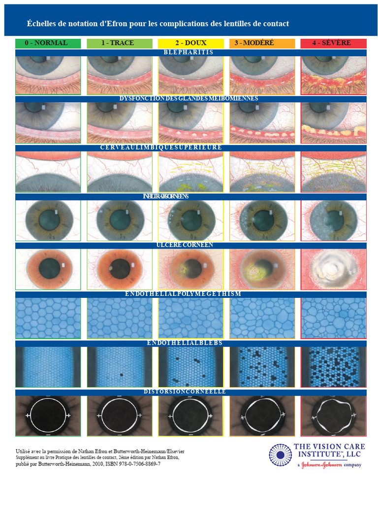 Échelles Efron pour Complications Lentilles | PDF | Spécialités ...