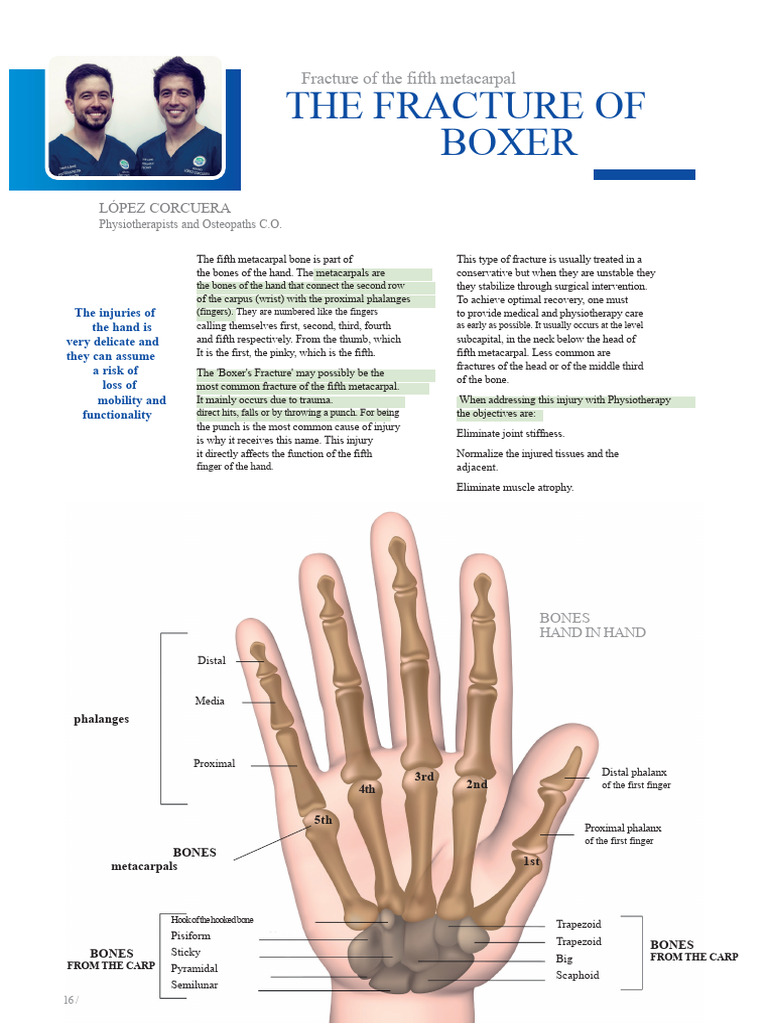 Boxer's Fracture 2 | PDF | Hand | Finger