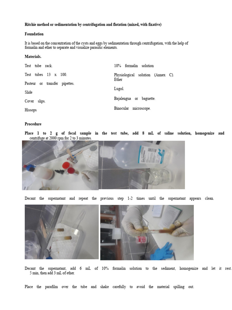 Ritchie Method | PDF