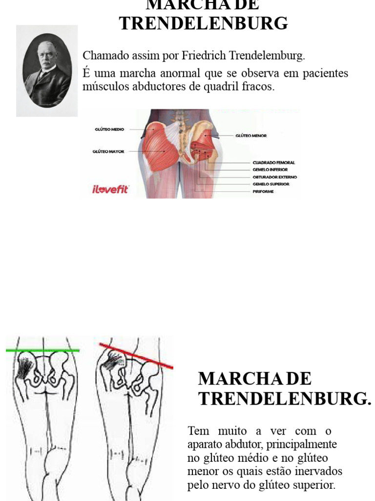 Marcha de Trendelenburg: Causas e Tratamento | PDF