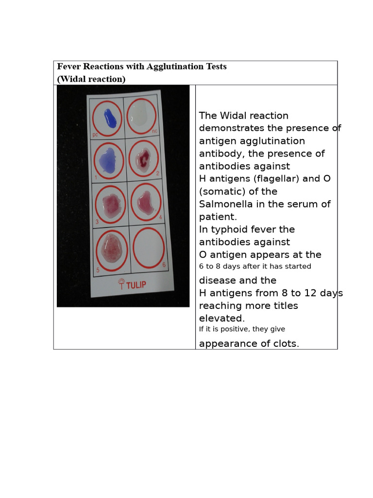 Febrile Reactions With Agglutination Tests | PDF