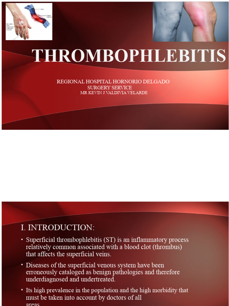 THROMBOPHLEBITIS.pptx | PDF | Vein | Thrombosis