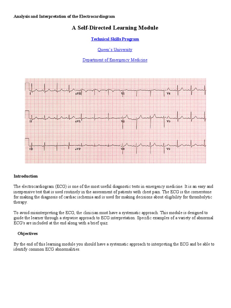 ECG Module Printable | Electrocardiography | Cardiac Arrhythmia