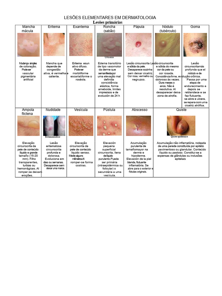 Lesões Elementares em Dermatologia | PDF | Pele | Epiderme