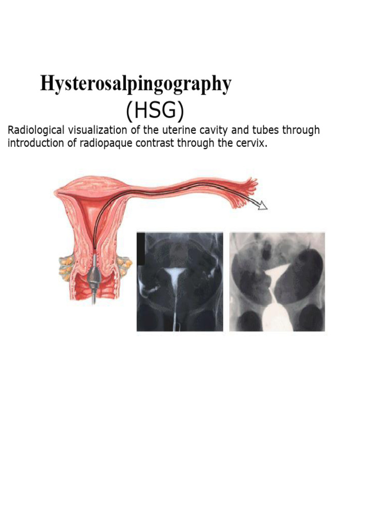 Practice 4 - Hysterosalpingography | PDF | Uterus | Mammal Female Reproductive System