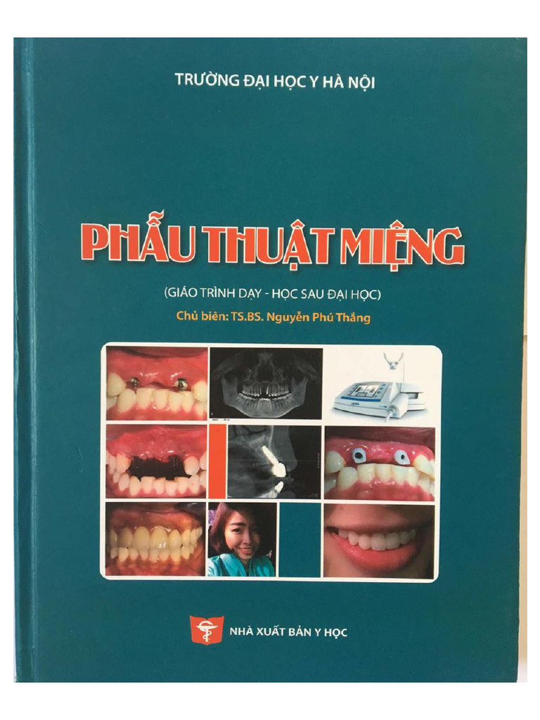 Phau Thuat Mieng SDH MHU | PDF