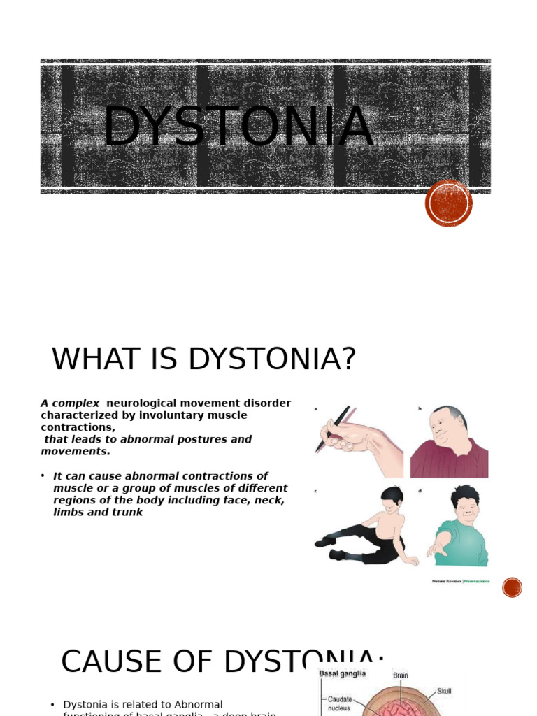 Dystonia | PDF