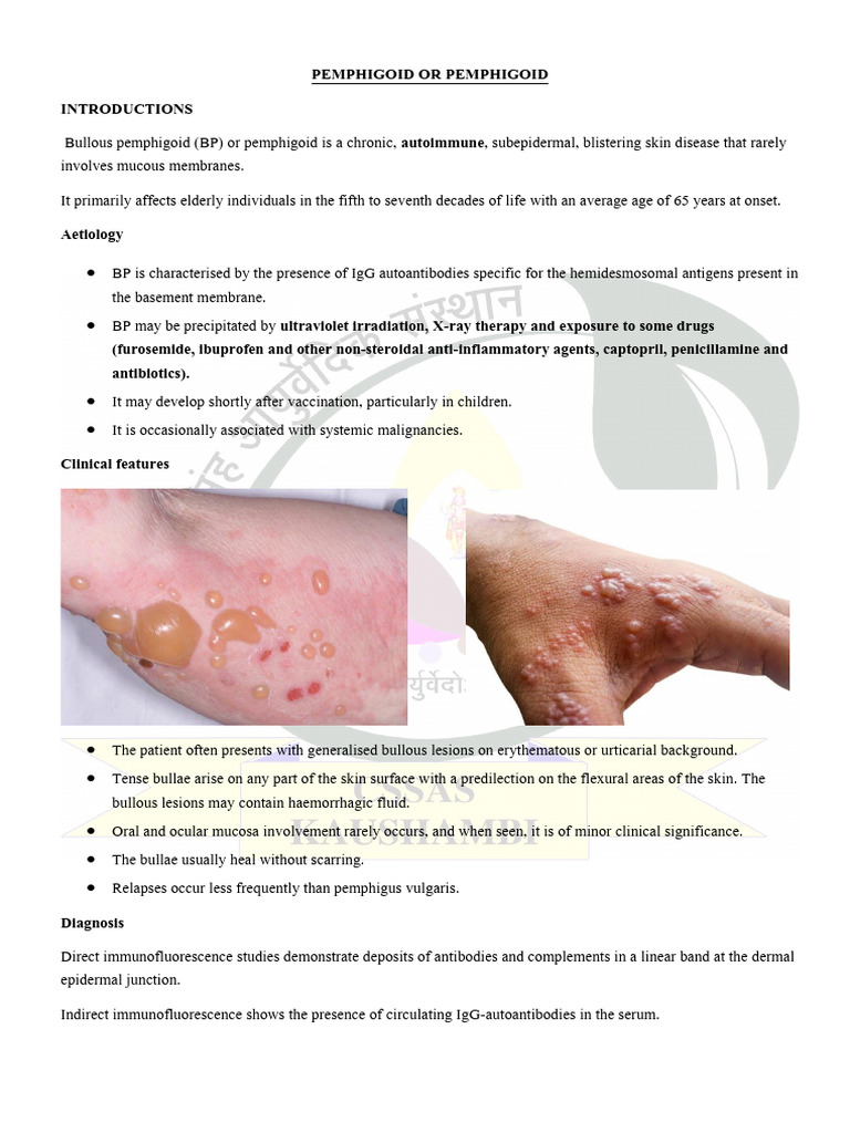 Pemphigoid or Pemphigoid | PDF