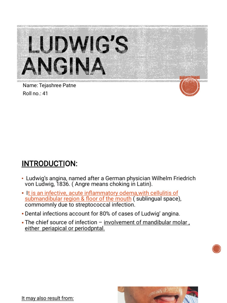 Ludwig's Angina - Tejashree Patne | PDF | Clinical Medicine | Diseases And Disorders