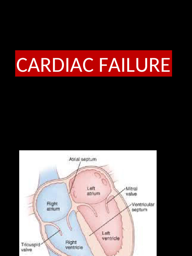 Understanding Cardiac Failure Types | PDF | Heart Failure | Heart