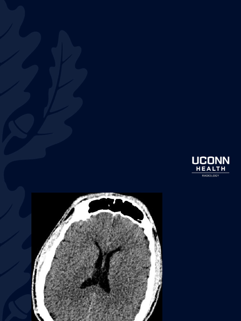 JC 2 Neuro CT MR Hypoxic Ischemic Encephalopathy 1 | PDF | Magnetic ...
