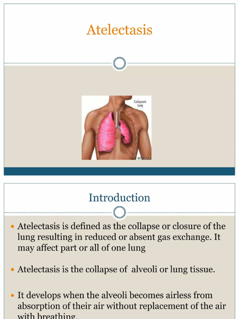 Atelectasis | PDF