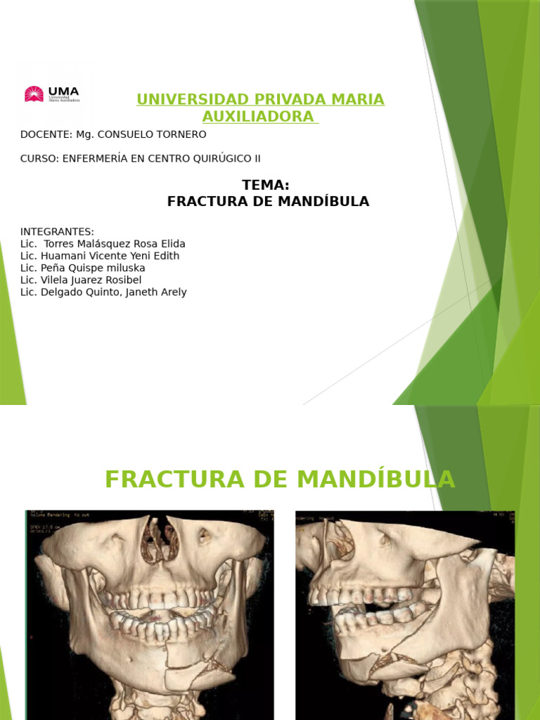 Fractura de Mandibula | PDF | Medicina CLINICA | Especialidades Medicas