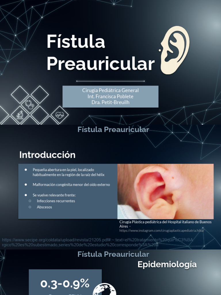 Fístula Preauricular - CX Pediátrica | PDF | Enfermedades y trastornos ...