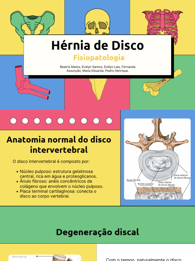 Hérnia de Disco .pdf | PDF