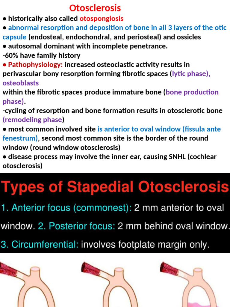 O To Sclerosis | PDF | Ear | Human Anatomy