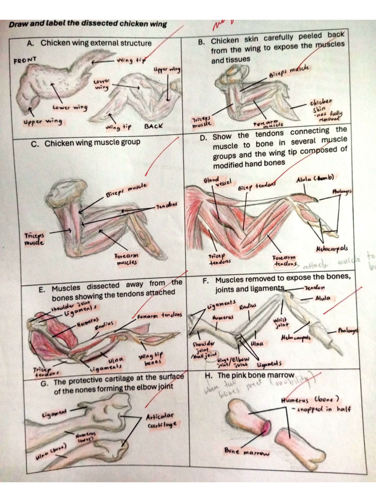 Musculoskeletal (Chicken Wing) | PDF