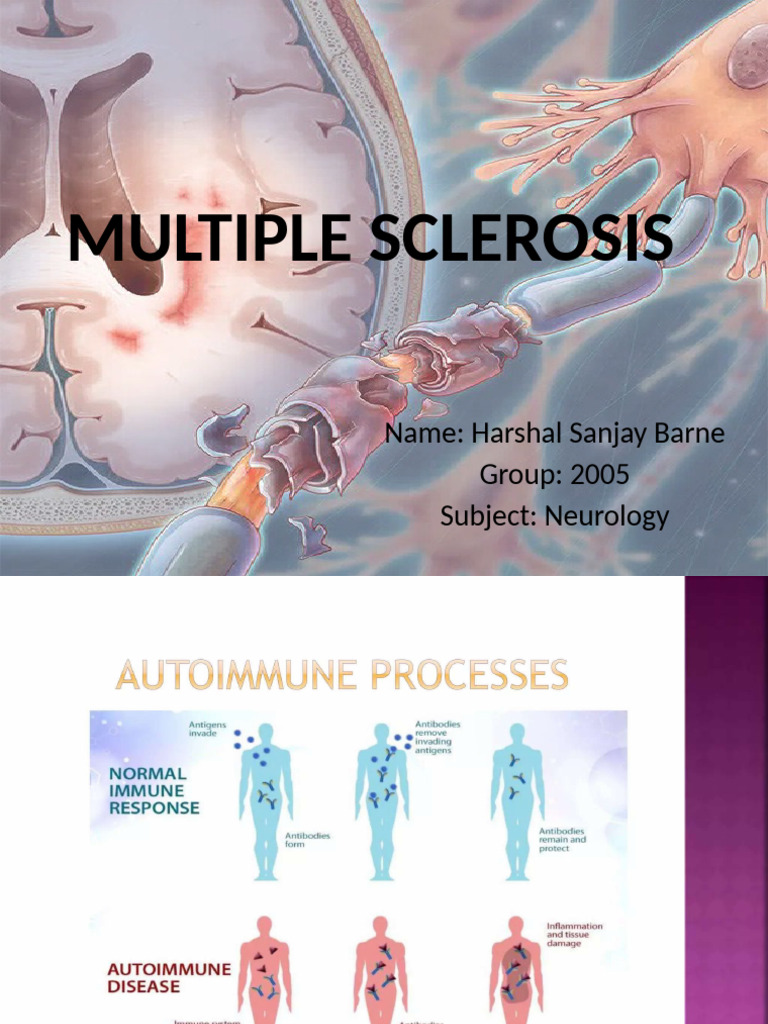 Multiple Sclerosis | PDF